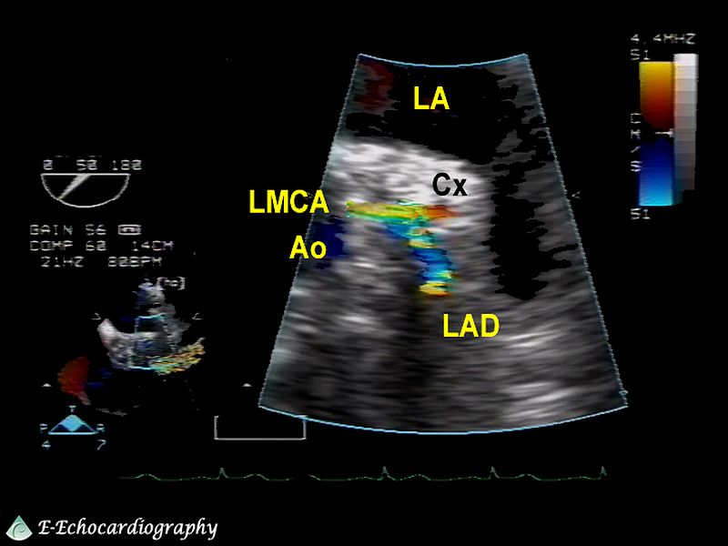 Coronary Arteries
