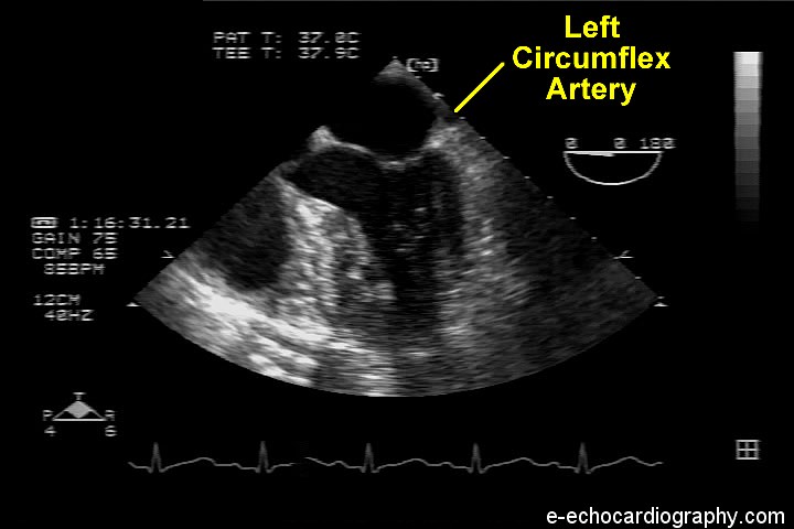Coronary Arteries