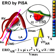 Effective Regurgitant Orifice by PISA