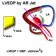 Left Ventricular End Diastolic Pressure