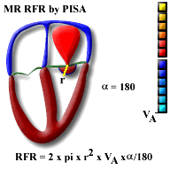 Regurgitant Flow Rate by PISA