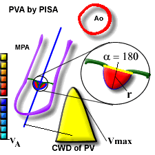 Pulmonary Valve Area by PISA