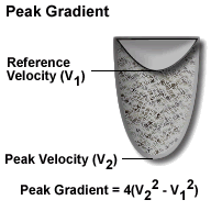 Aortic Valve Gradient