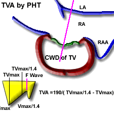 Tricuspid Valve Area by Pressure Half-Time (PHT)