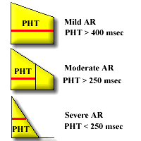 Aortic Regurgitation Pressure Half-Time
