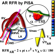 Regurgitant Flow Rate by PISA