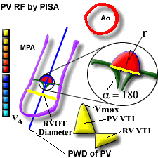 Regurgitant Volume by PISA