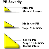Pulmonary Regurgitation Decay Slope