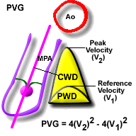 Pulmonary Valve Gradient