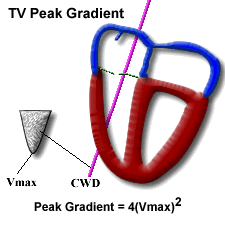 Tricuspid Valve Gradient